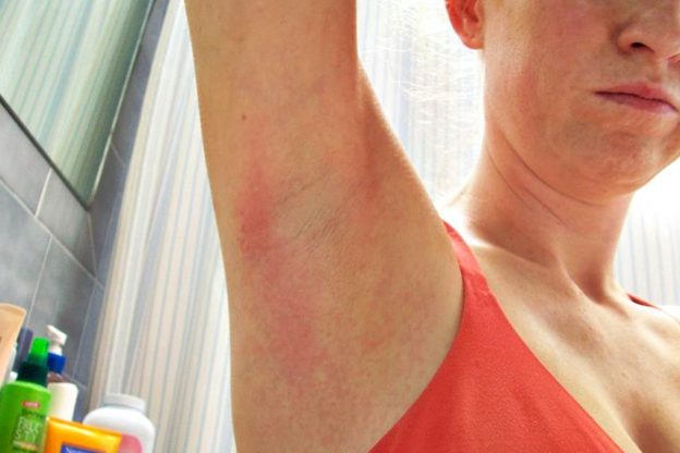 Tips To Keep Your Skin Healthy After a Hurricane | The Woodruff Institute